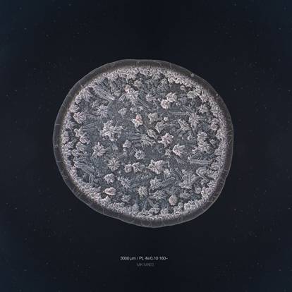 The Beauty of Tears Seen Through Microscopes – Fubiz Media